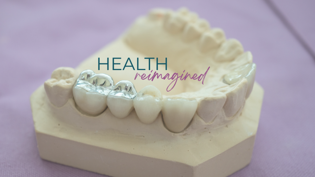 Viewing Dental Amalgam Holistically – Understanding Systemic ...